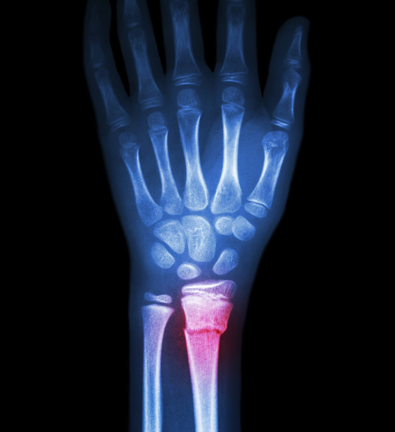 Cambridge Bone and Joint